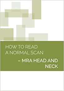 How to Read a Normal Scan: MRA HEAD AND NECK (High Quality Image PDF ...